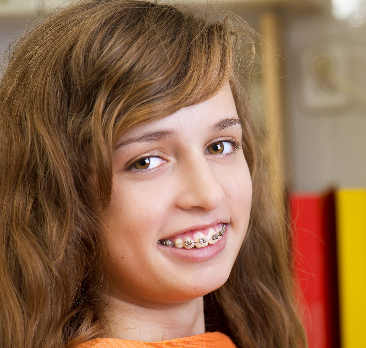 What To Expect During Damon Braces Treatment Dental Hygiene Association what-to-expect-during-damon-braces-treatment-dental-hygiene-association